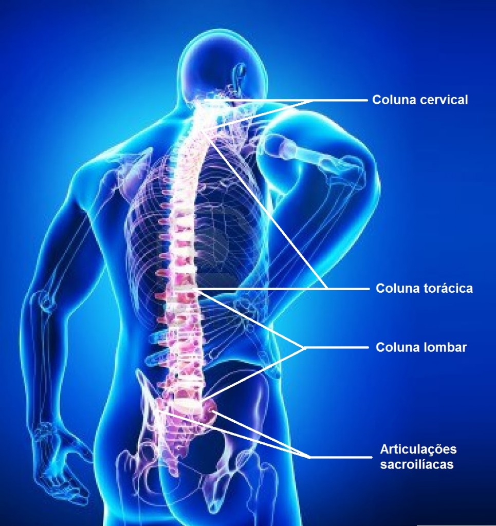 Pesquisa com pacientes de Espondilite Anquilosante no Brasil - Artrite ...