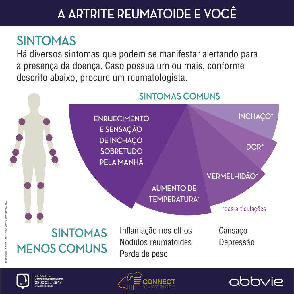 Conheça os sintomas da artrite reumatoide - Artrite Reumatóide