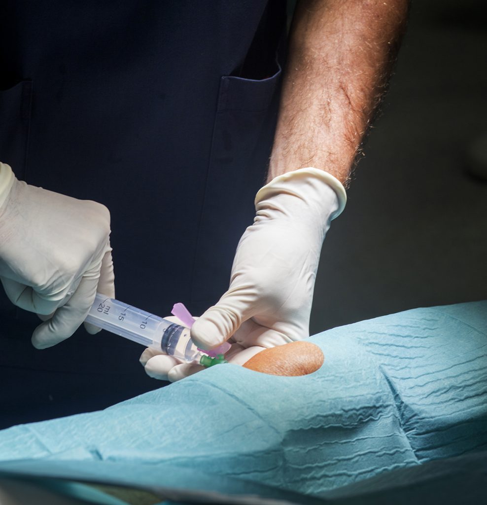 Anaesthtist anaesthetic injection in knee for surgery hospital ...